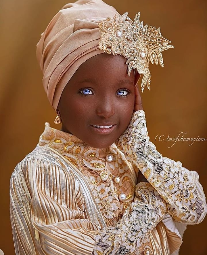 They Were Abandoned Because of Their Eye Colour